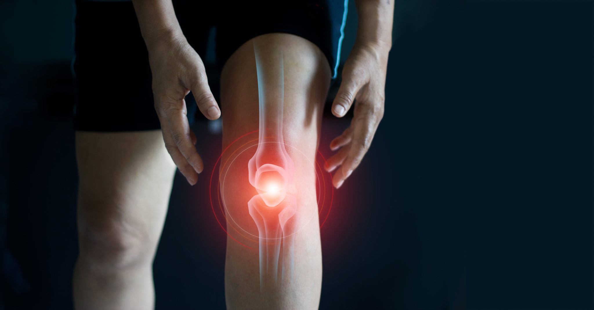 Hip and Knee Academy | PatientsLearn